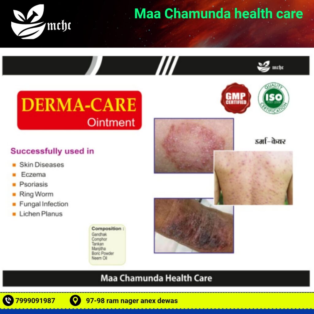 DERMACARE/ KHUJLI NA OINTMENT (30 GM) – Mchcayurveda